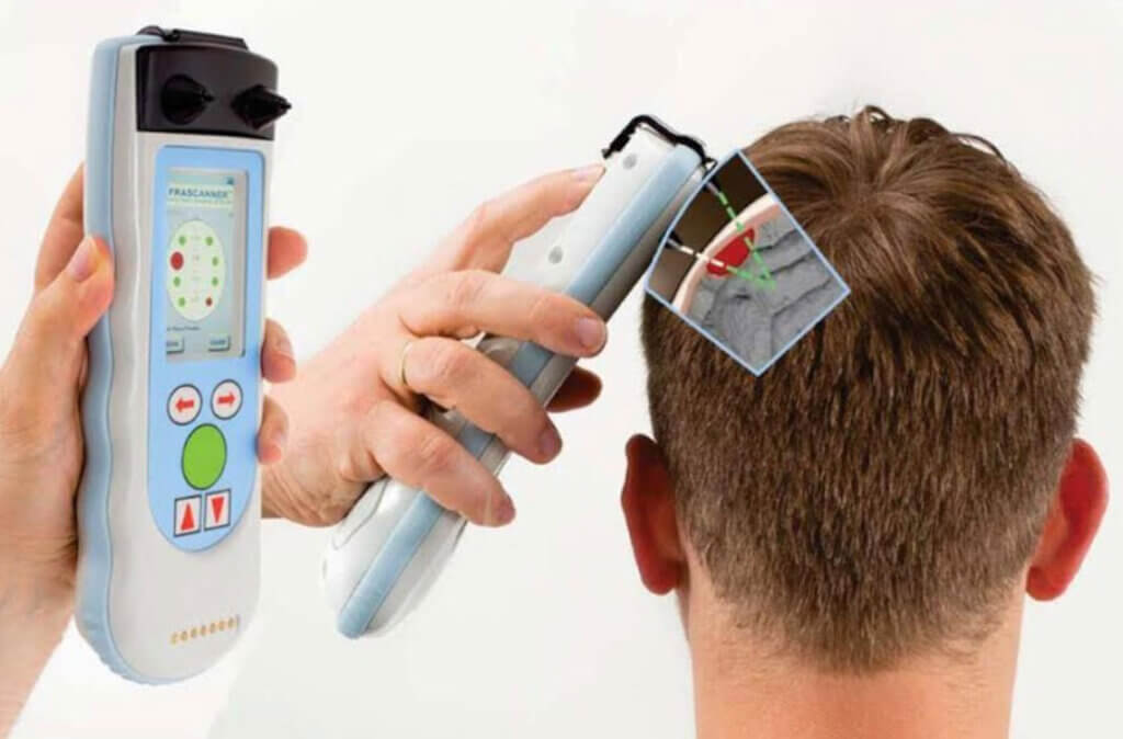 Handheld Brain Scanner - PSI Software